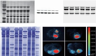 How to select gel imaging system？